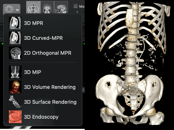 Best Dicom Viewers For Windows Macos Web And Mobile 2024 Radiogyan
