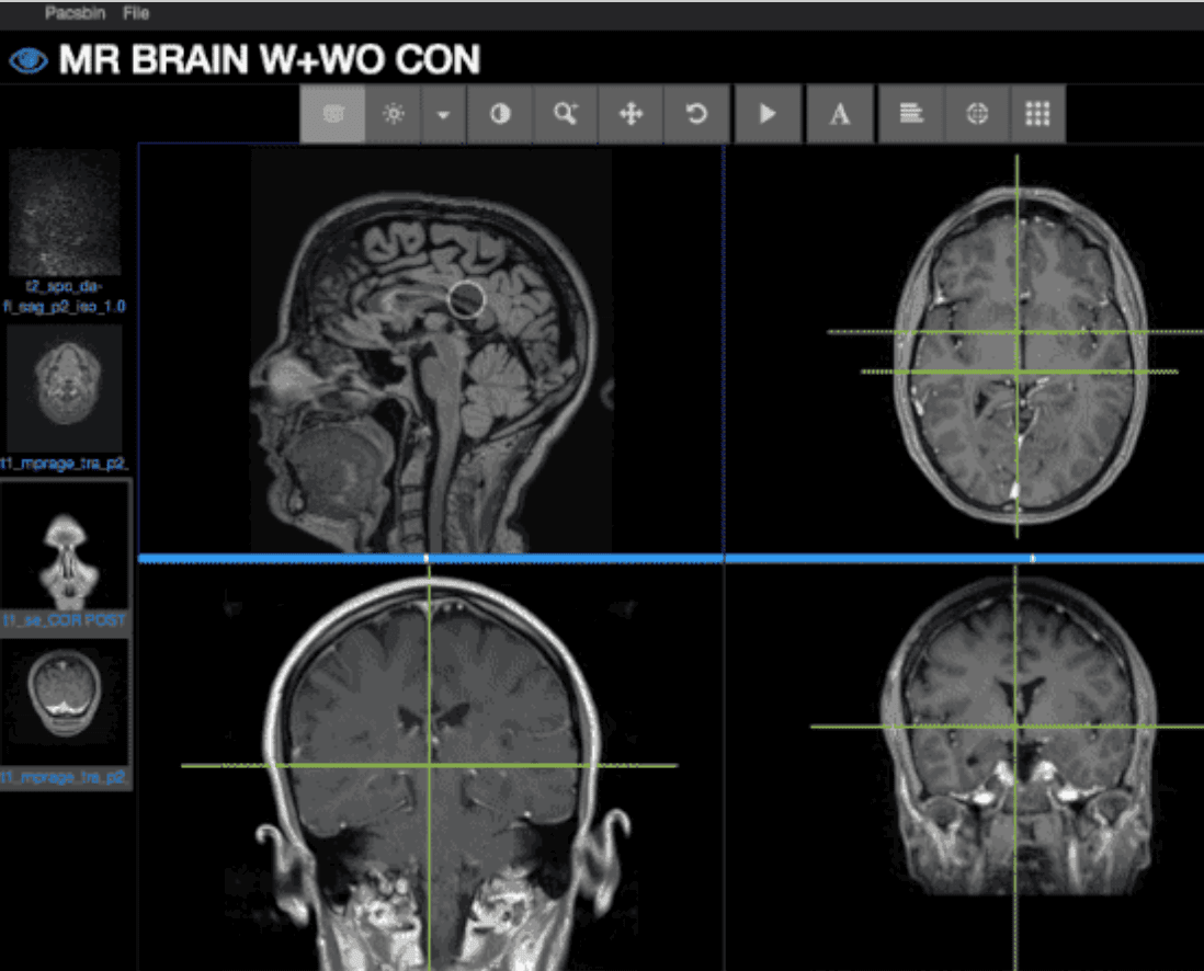 Best Dicom Viewers For Windows Macos Web And Mobile 2024 Radiogyan