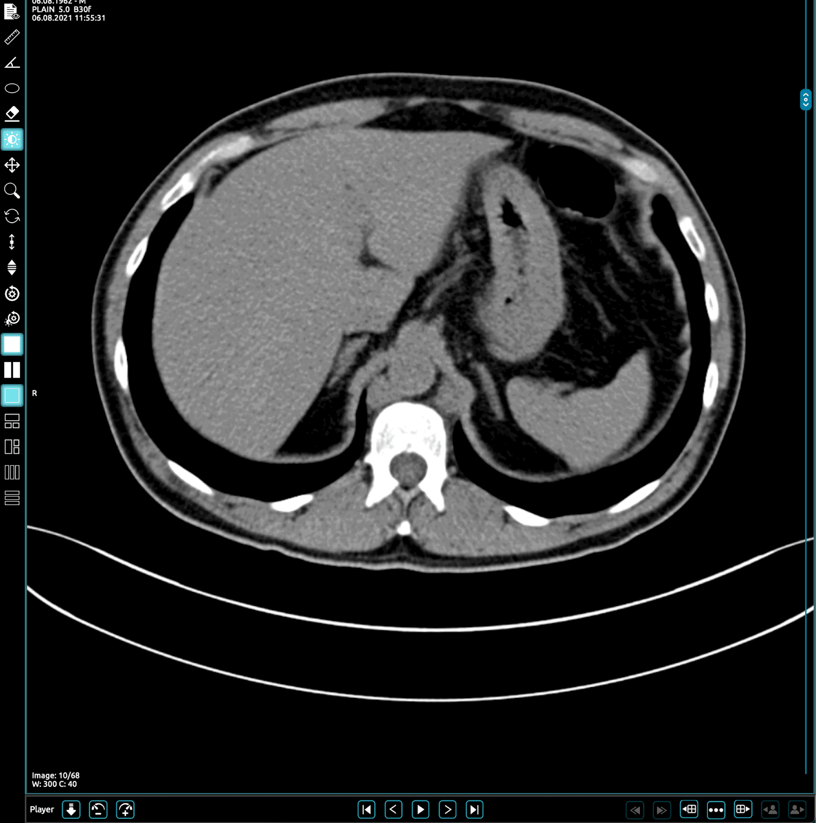 Best DICOM Viewers for Windows, MacOS, Web & Mobile - 2024 - RadioGyan